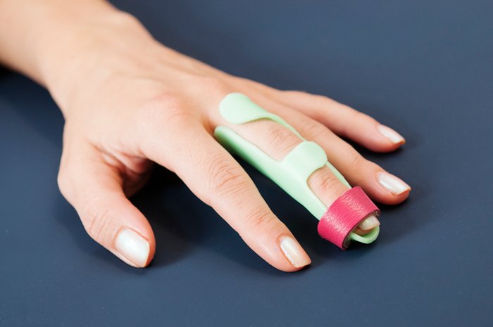 Schienenversorgung | Ergotherapie und Handtherapie, Köln