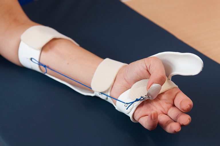 Schienenversorgung | Ergotherapie und Handtherapie, Köln