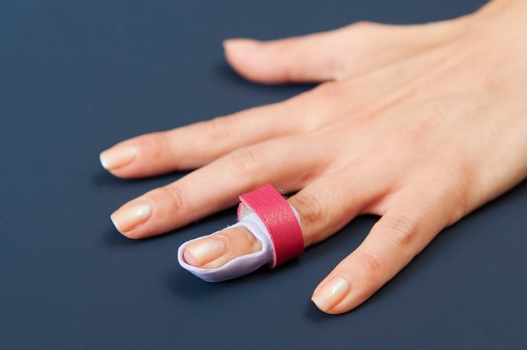 Schienenversorgung | Ergotherapie und Handtherapie, Köln